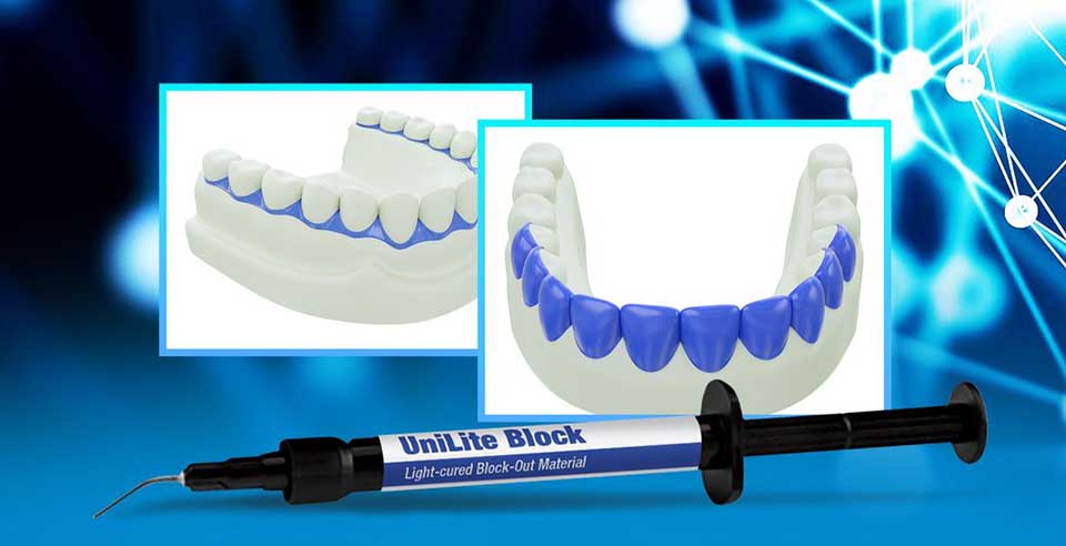 DSI UniLite Block-Out Resin- Blocking Out Undercuts on Teeth Impressio
